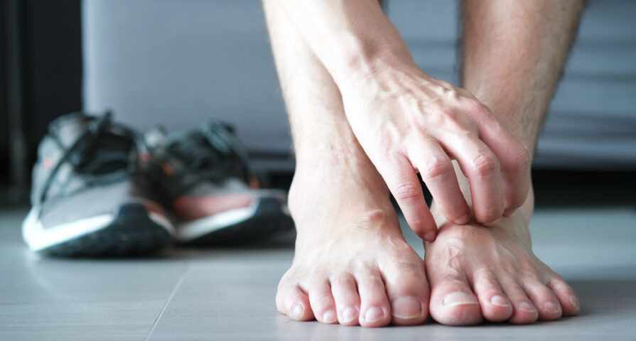 Athlete's Foot: Types, Symptoms, Causes, and Treatments - ActiveBeat